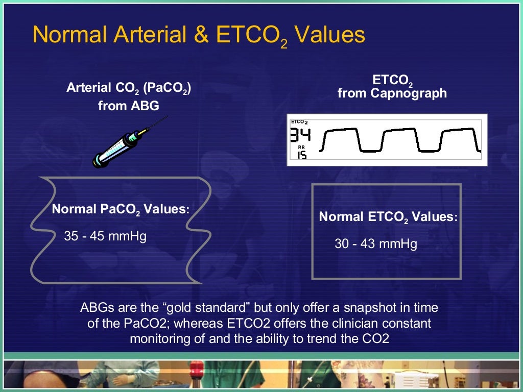 CC - EtCO2 and Waveform Capnography