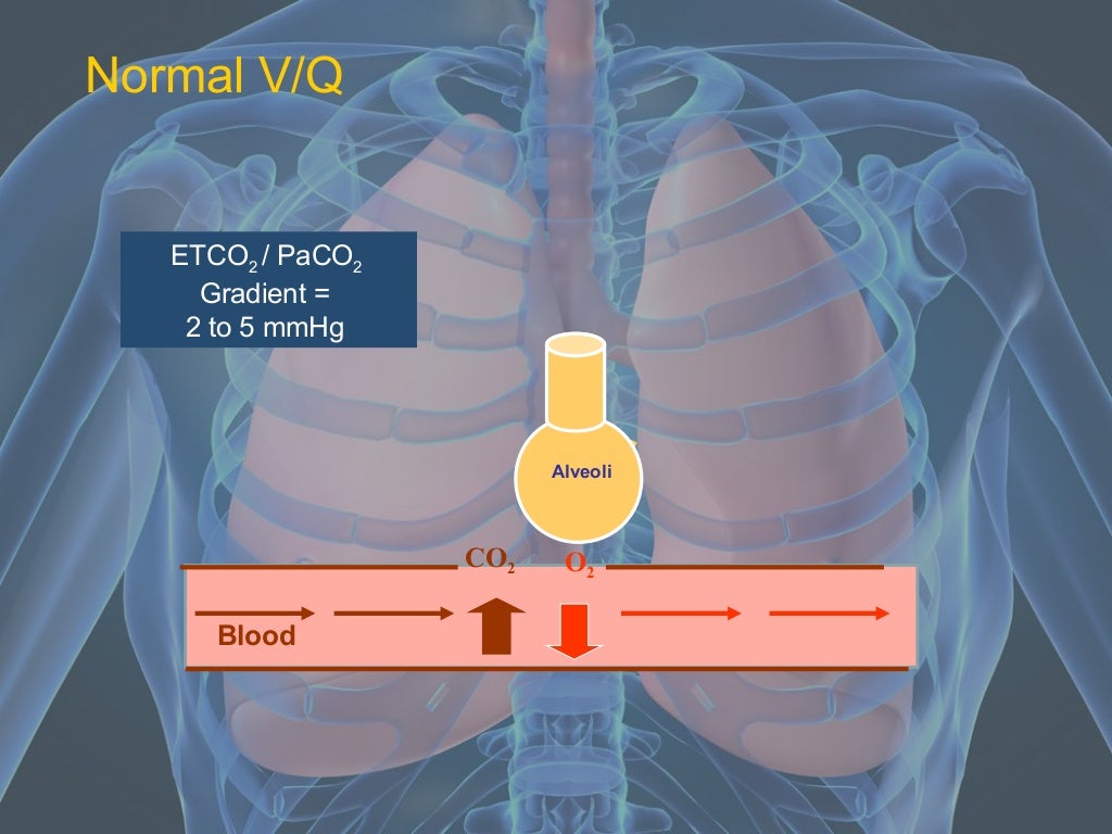 CC - EtCO2 and Waveform Capnography