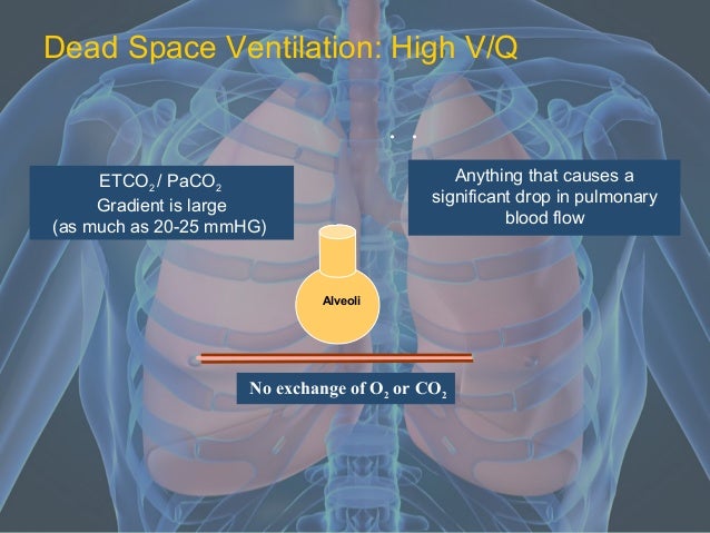 CC - EtCO2 and Waveform Capnography