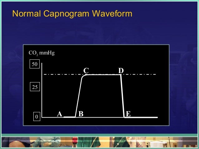 CC - EtCO2 and Waveform Capnography