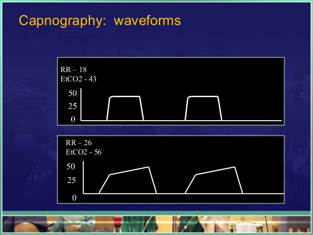 CC - EtCO2 and Waveform Capnography