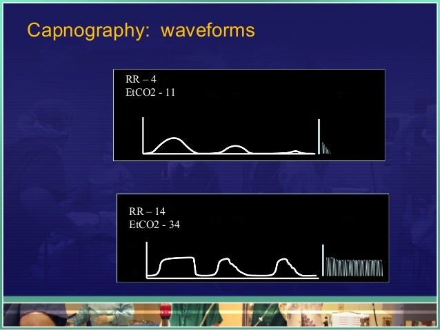 CC - EtCO2 and Waveform Capnography