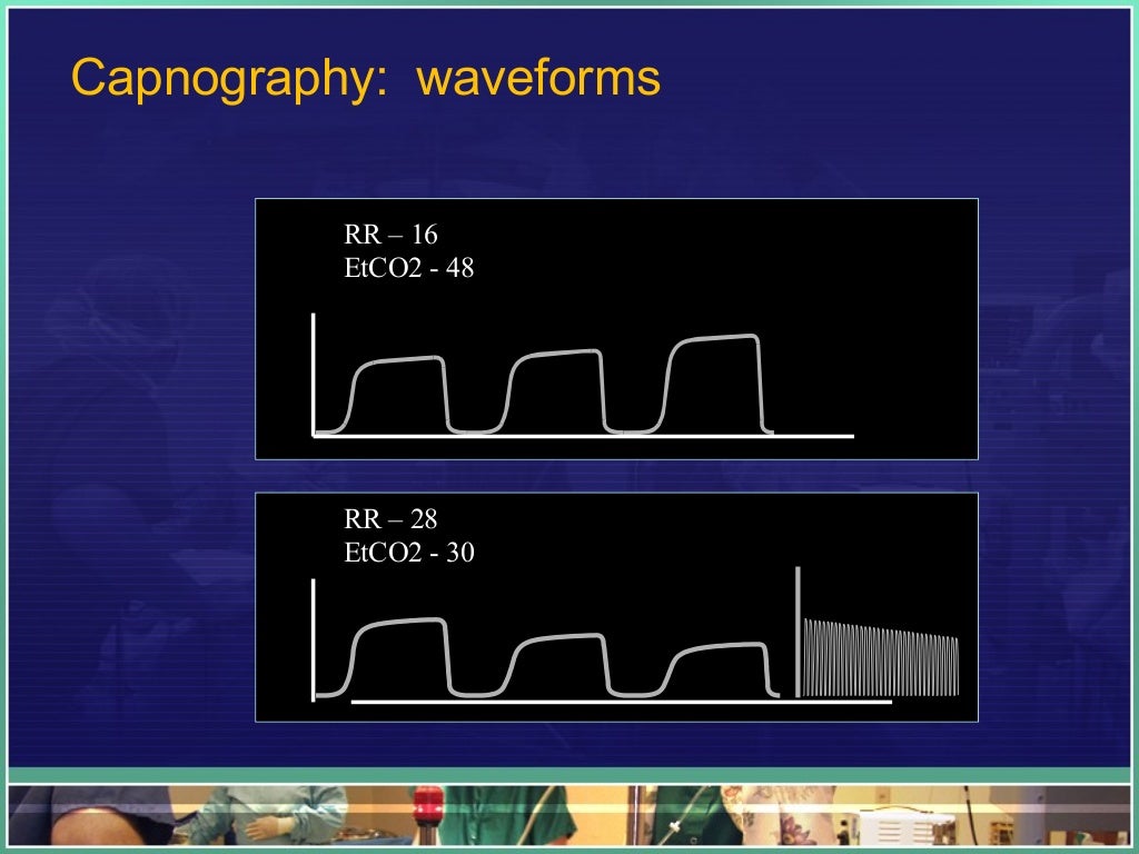 CC - EtCO2 and Waveform Capnography