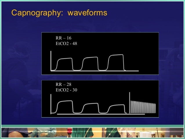 CC - EtCO2 and Waveform Capnography
