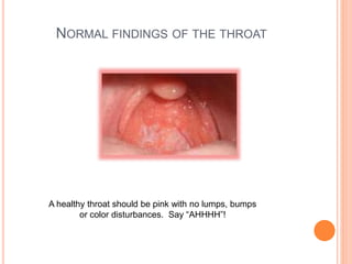 Nose_ Mouth_ and Throat--Physical Assessment--Power Point | PPTX
