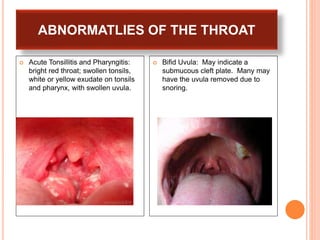 Nose_ Mouth_ and Throat--Physical Assessment--Power Point | PPT
