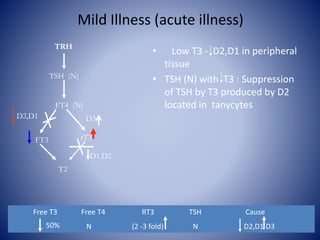 Sick euthyroid syndrome | PPTX