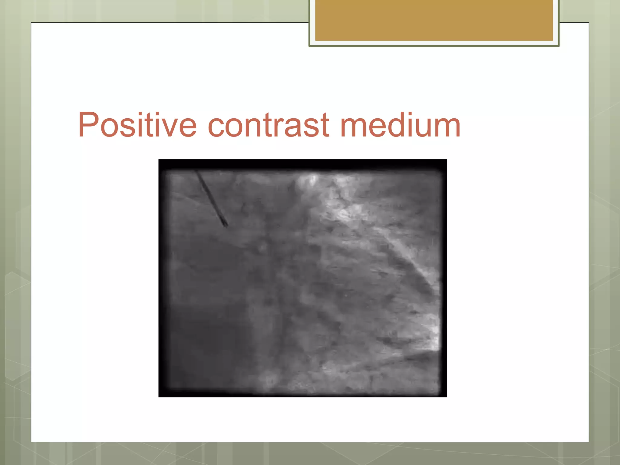 Contrast Media in Radiology | PPTX
