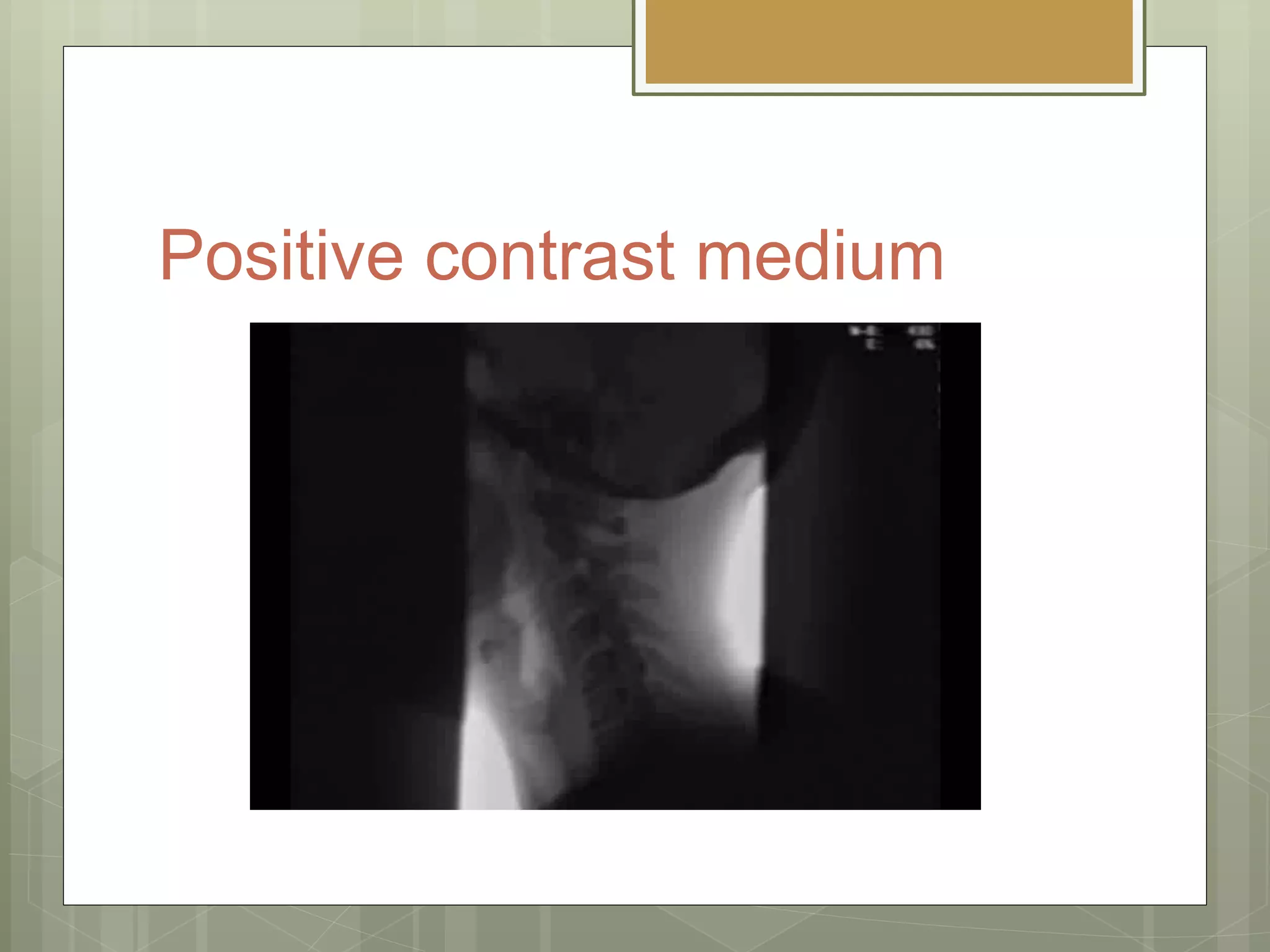 Contrast Media in Radiology | PPTX
