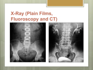 Contrast Media in Radiology | PPTX