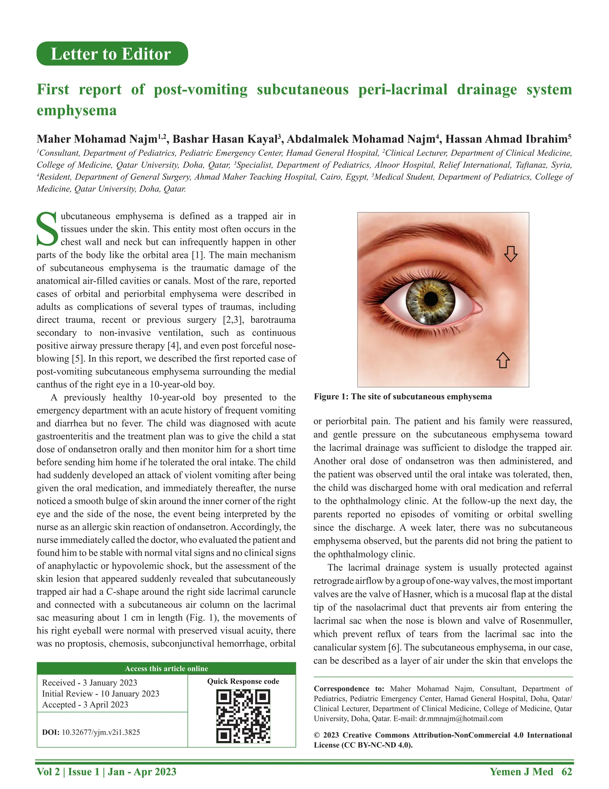 First report of post-vomiting subcutaneous peri-lacrimal drainage ...