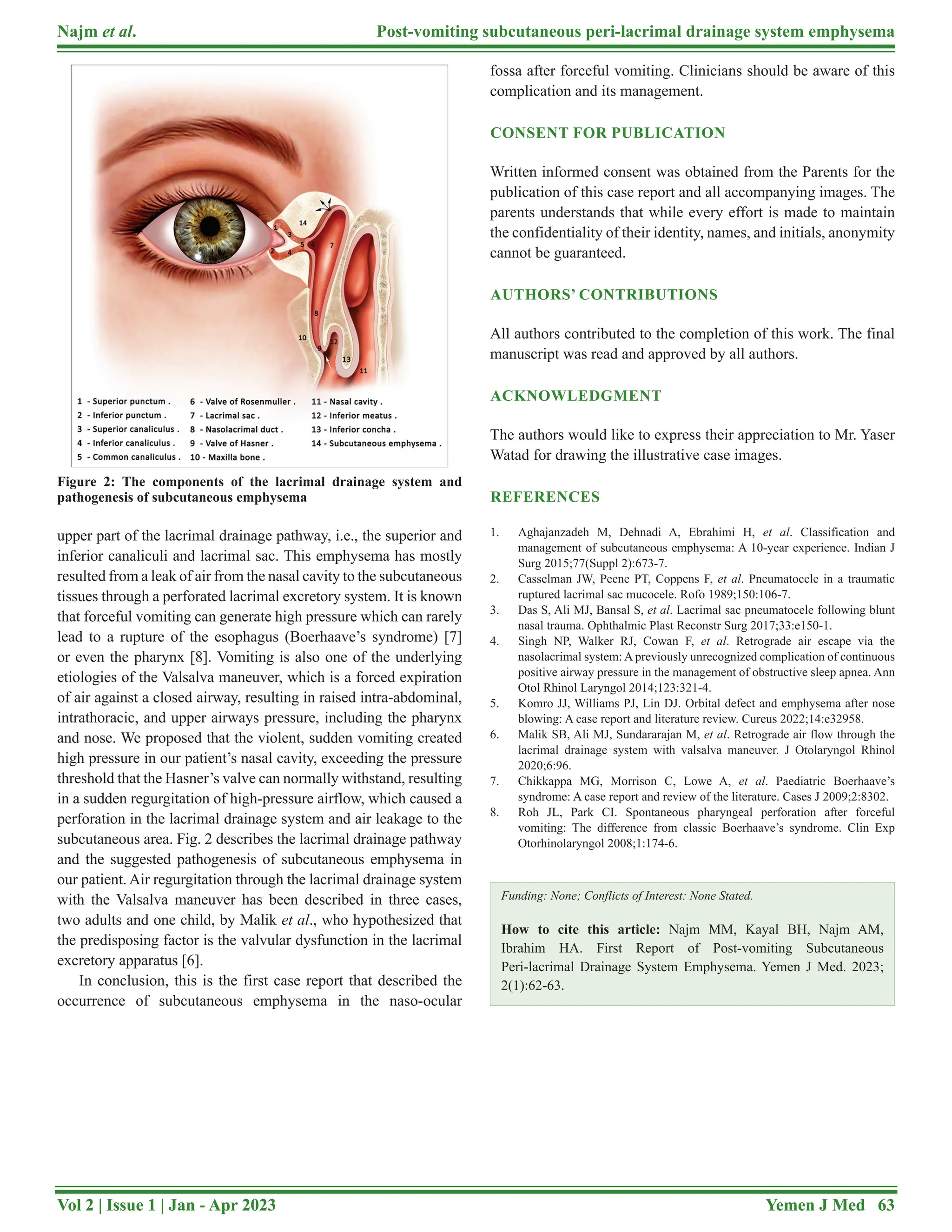 First report of post-vomiting subcutaneous peri-lacrimal drainage ...