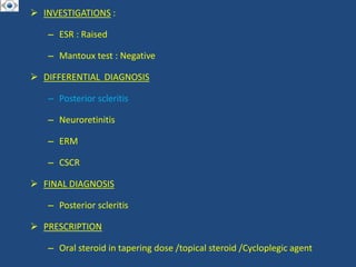 POSTERIOR_SCLERITIS presentation dhb.pptx