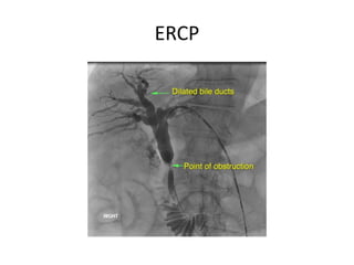 Formation of a multi-discipline advanced endoscopy inpatient team | PPTX
