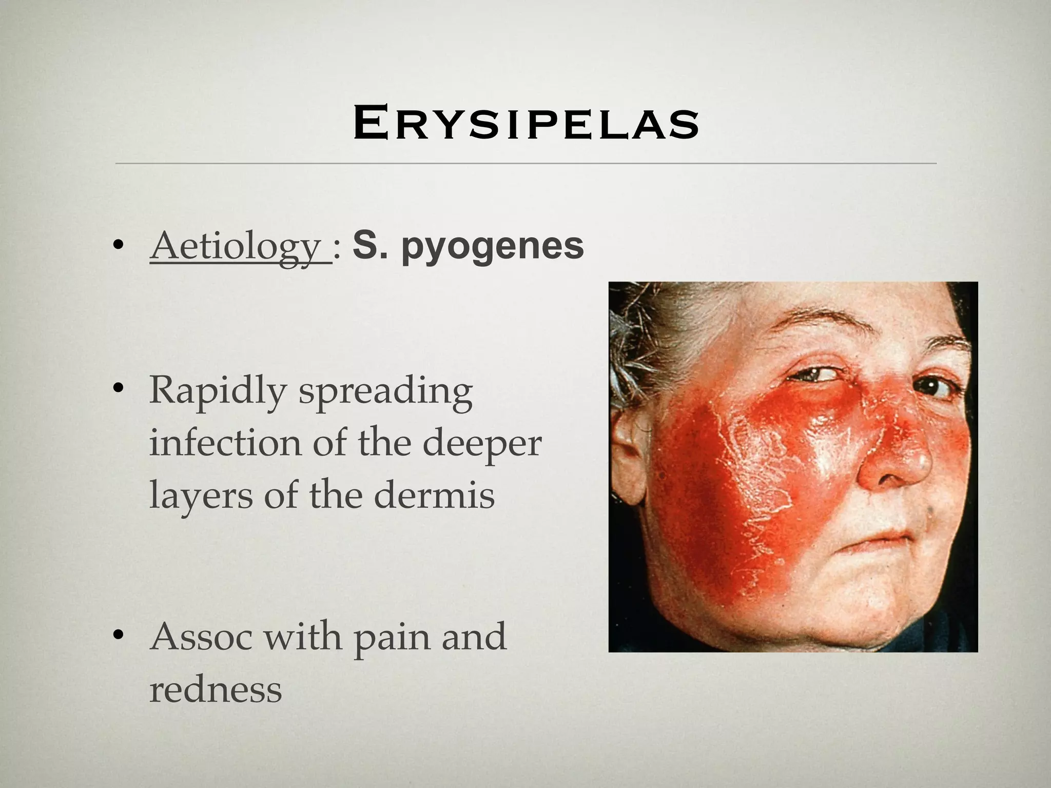 Skin and Soft Tissue Infections | PDF