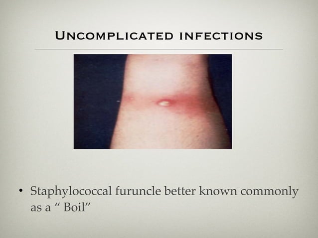 Skin and Soft Tissue Infections | PDF