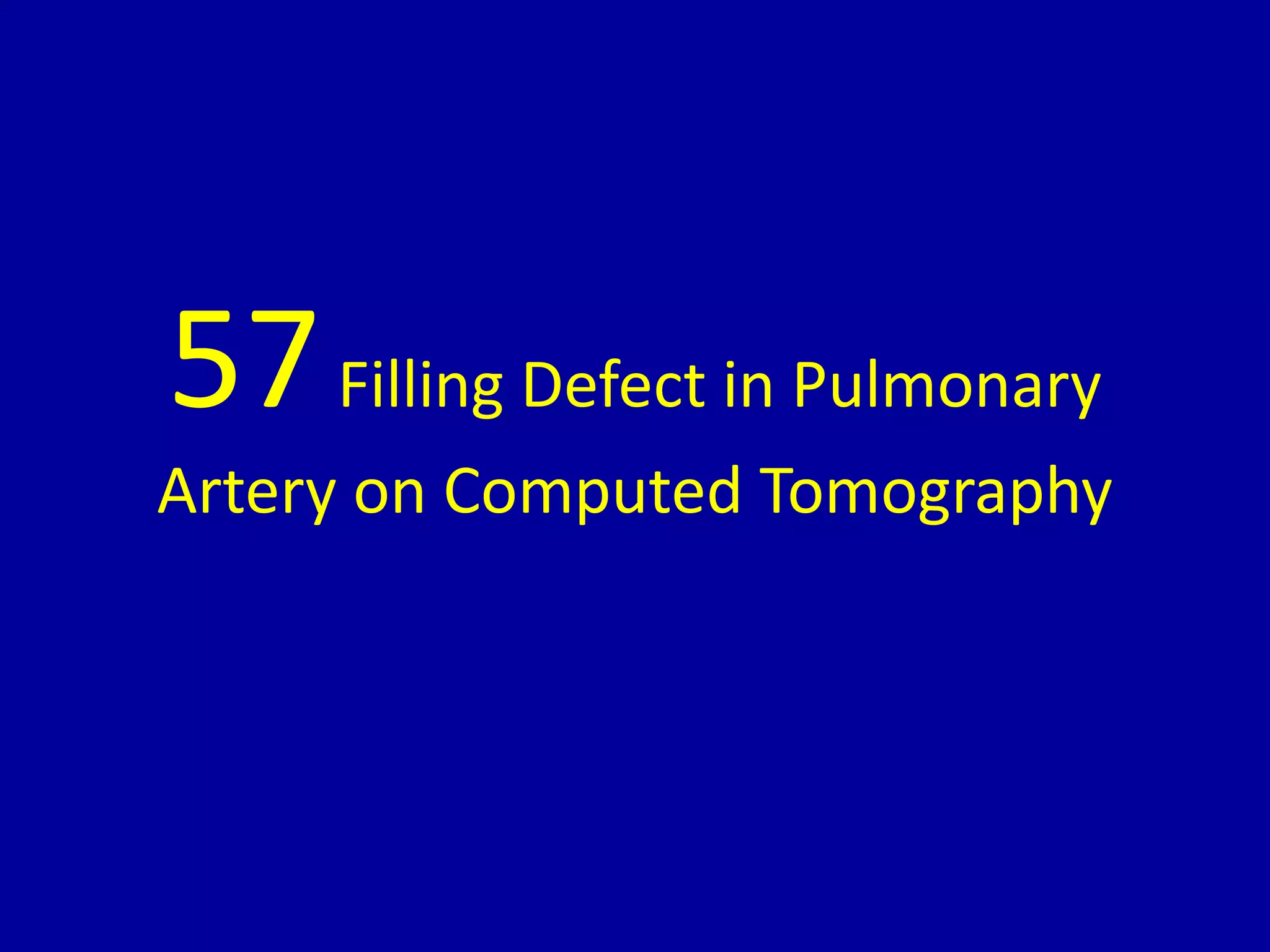 57 filling defect in pulmonary artery on computed | PPTX