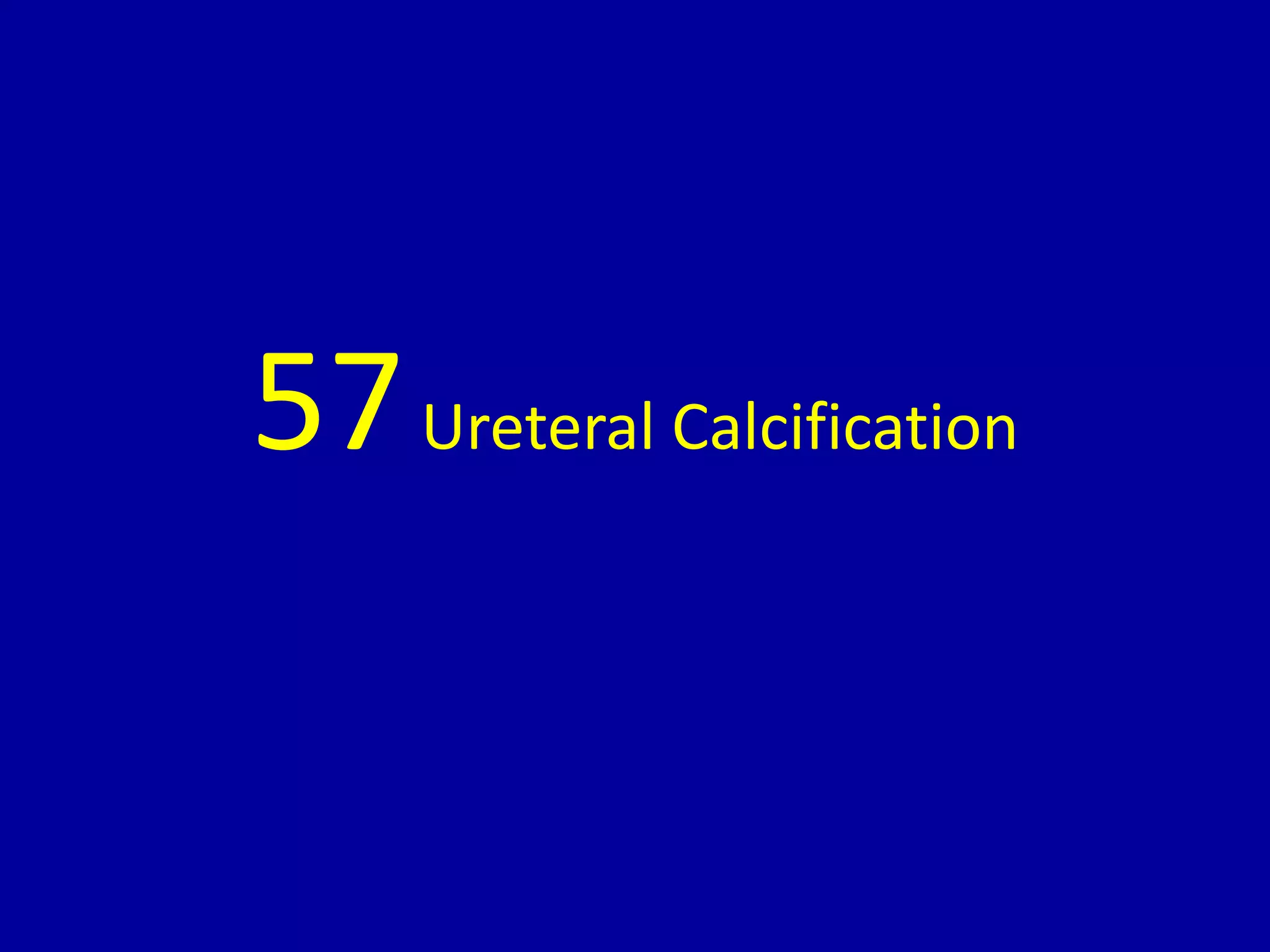 57 ureteral calcification | PPTX