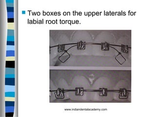 Refined begg technique | PPT