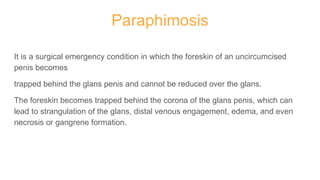 58- Phimosis and paraphimosis by Gurpreet.pptx