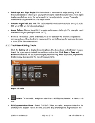 D-Solix-User-Manual_optovue_ophthalmology | PDF