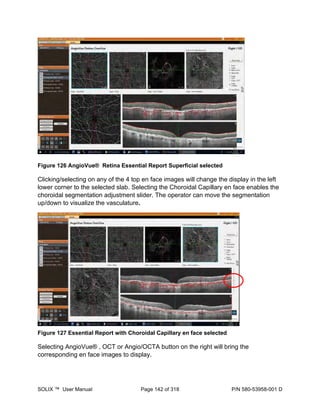 D-Solix-User-Manual_optovue_ophthalmology | PDF