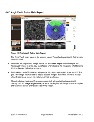 D-Solix-User-Manual_optovue_ophthalmology | PDF