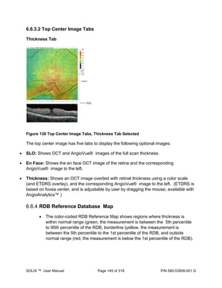 D-Solix-User-Manual_optovue_ophthalmology | PDF