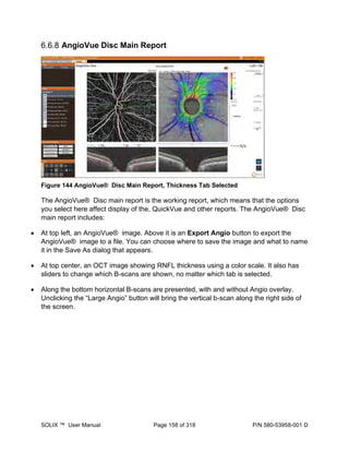 D-Solix-User-Manual_optovue_ophthalmology | PDF