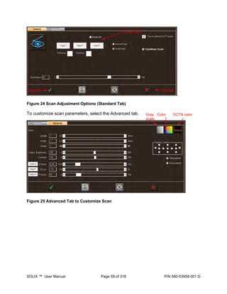 D-Solix-User-Manual_optovue_ophthalmology | PDF