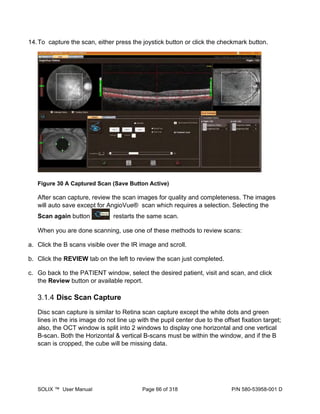 D-Solix-User-Manual_optovue_ophthalmology | PDF