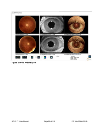 D-Solix-User-Manual_optovue_ophthalmology | PDF