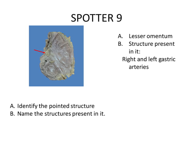 581732808-Gross-Spotters-Abdomen-Pelvis-Dr-kalpana.pdf