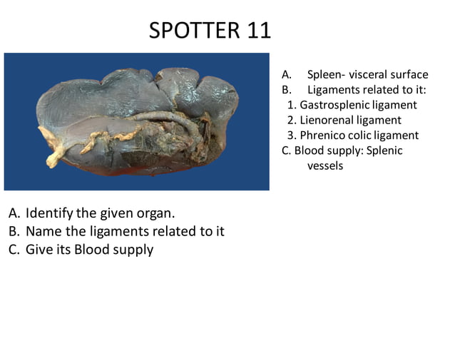 581732808-Gross-Spotters-Abdomen-Pelvis-Dr-kalpana.pdf