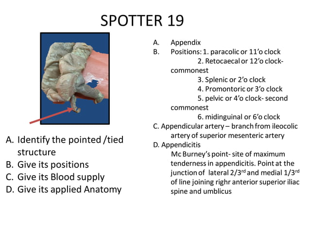 581732808-Gross-Spotters-Abdomen-Pelvis-Dr-kalpana.pdf