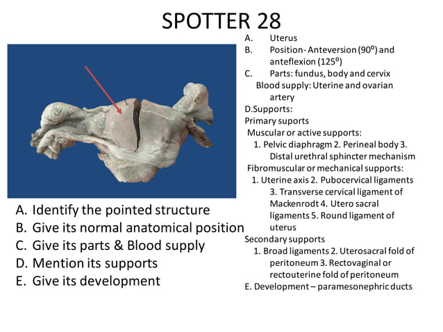 581732808-Gross-Spotters-Abdomen-Pelvis-Dr-kalpana.pdf