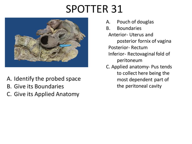 581732808-Gross-Spotters-Abdomen-Pelvis-Dr-kalpana.pdf
