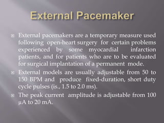 pacemaker | PPT