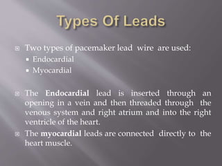 pacemaker | PPT