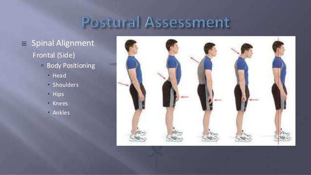 Postural Analysis