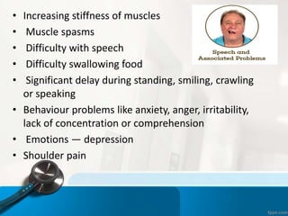 hemiplegia | PPTX