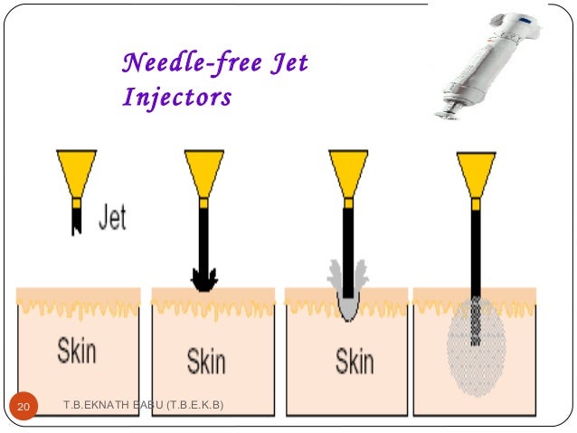 TRANSDERMAL DRUG DELIVERY SYSTEM