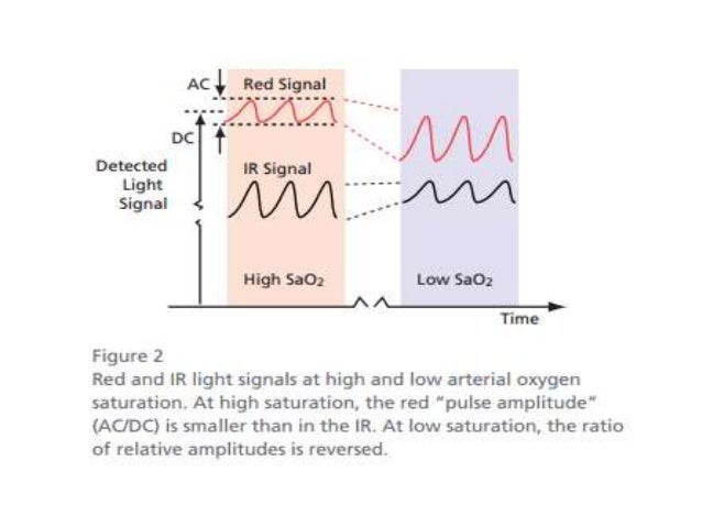 pulse oximetry final