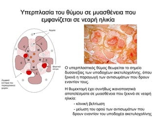 Klinikh Eikona ths Myasthenias - Amelia Evoli (Greek) | PPS