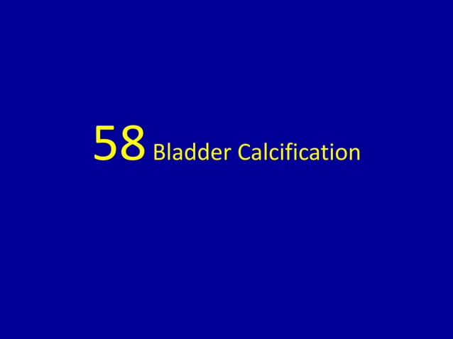 58 bladder calcification | PPTX
