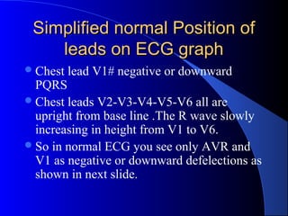 ECG | PPT