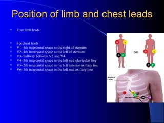 ECG | PPT