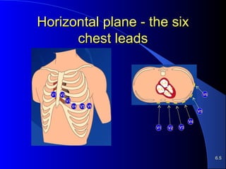 ECG | PPT