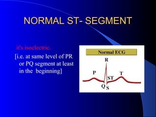 ECG | PPT
