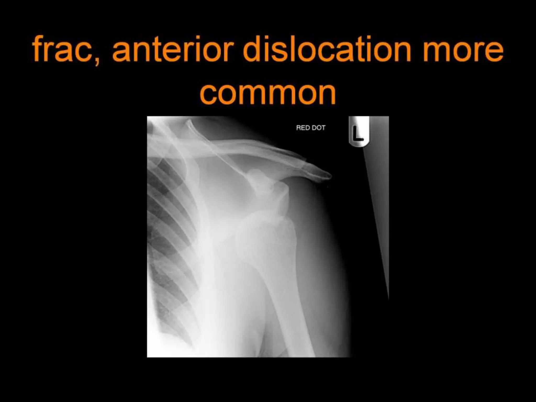 59-Dr Ahmed Esawy imaging oral board MSK imaging part V fracture B ...